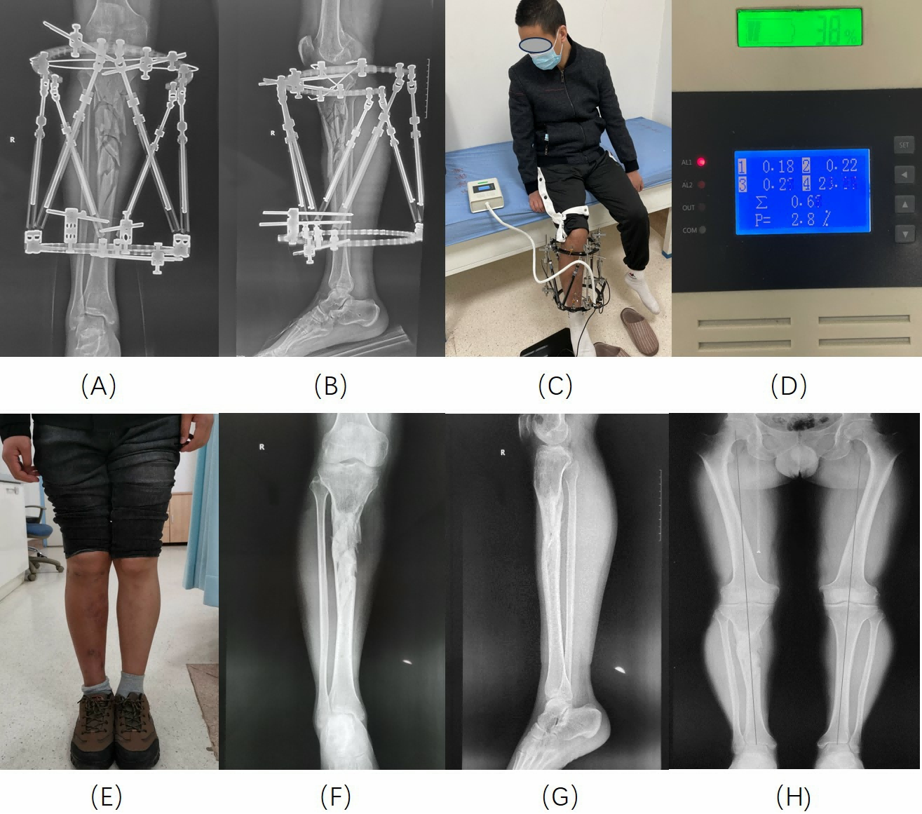 Biomedical Engineering Communications